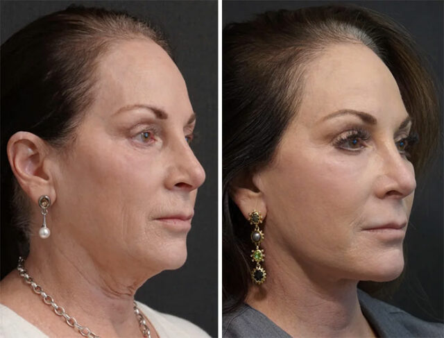 25 People Who Look Like They Found The Fountain Of Youth After A ...