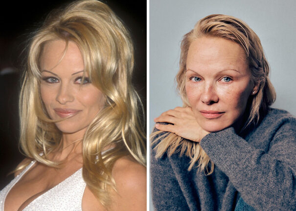 25 Facial Transformations That Have Made Famous Stars Practically ...