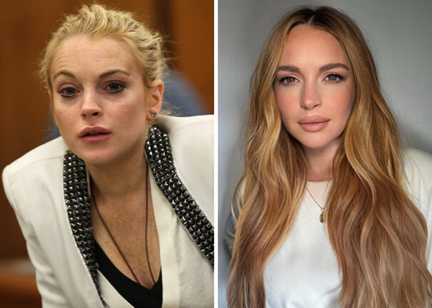 25 Facial Transformations That Have Made Famous Stars Practically ...