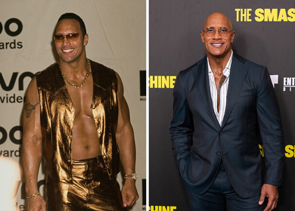 25 Facial Transformations That Have Made Famous Stars Practically ...