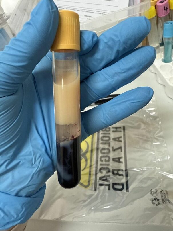 25 Medical Posts That Remind Us Of The Remarkable Nature Of The Human ...