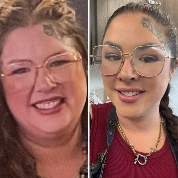 35 People Share Comparison Pics Of Their Before-And-After “Ozempic ...