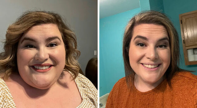 35 People Share Comparison Pics Of Their Before-And-After “Ozempic ...
