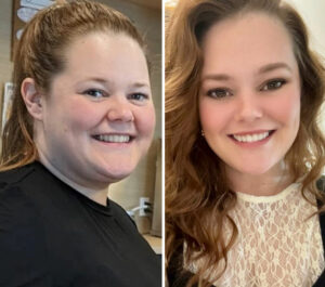35 People Share Comparison Pics Of Their Before-And-After “Ozempic ...
